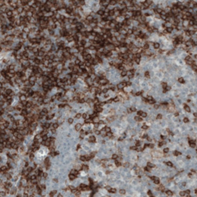 CD4, Mouse anti-Human, Clone: CL0395, Abnova 100μL; Unconjugated ...