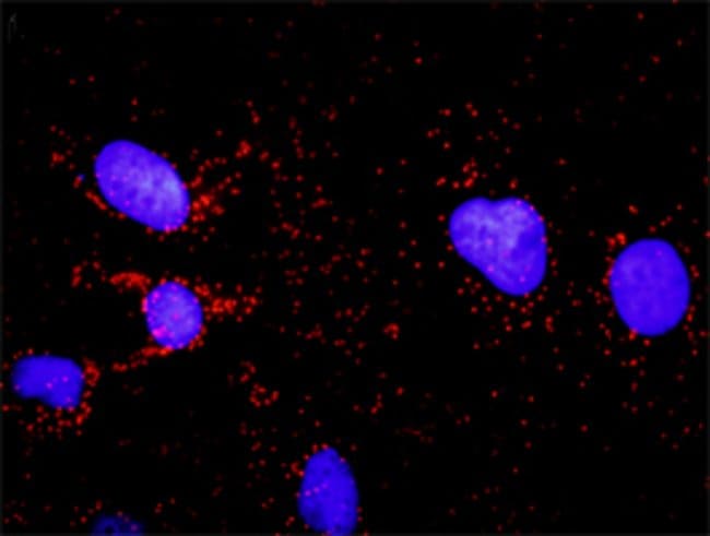 GSK3B(phospho S9) GSK3B Protein Phosphorylation Antibody Pair, Abnova 1 ...