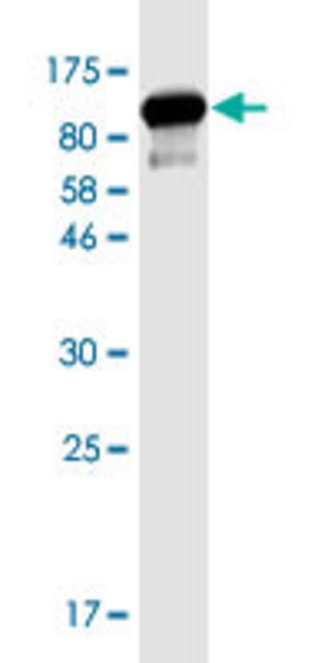 Cdh11 Mouse Anti Human Clone 2d1 Abnova™ 100μg Unconjugated