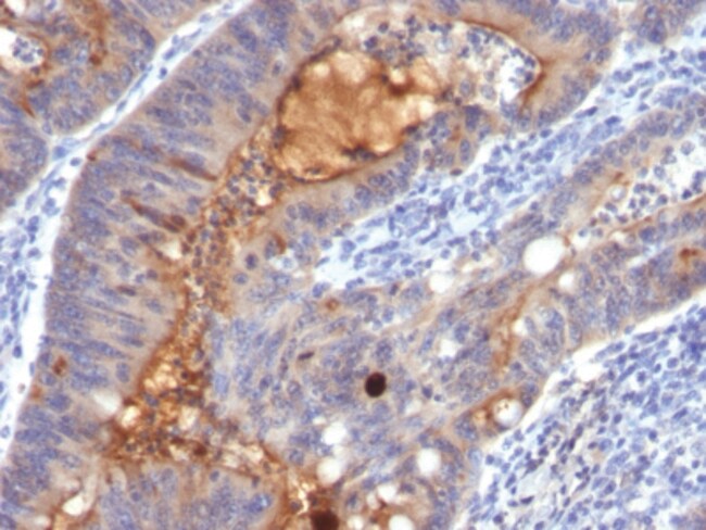 IgA Secretory Component / ECM1 Mouse, Clone: SPM217, enQuireBio 100 μg ...