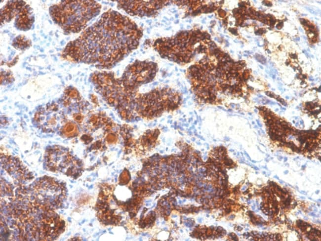 Parathyroid Hormone Mouse, Clone: PTH/1175, enQuireBio™ 100 μg | Fisher ...