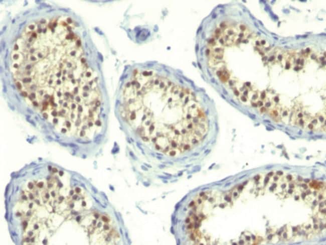Thymidylate Synthase Mouse, Clone: TS106 + TMS715, enQuireBio™ 100 μg ...