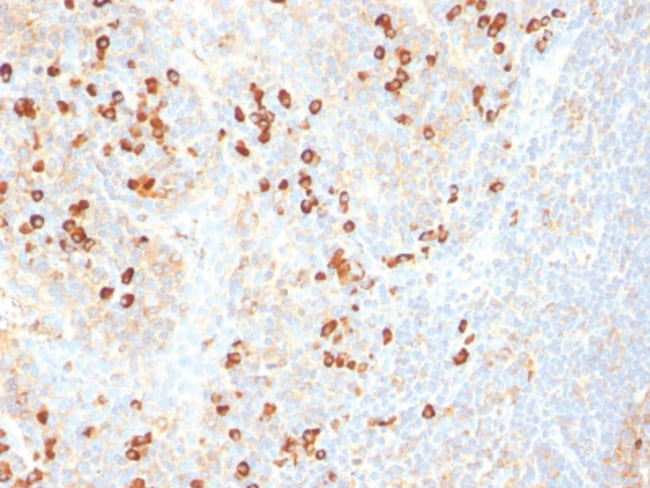 Plasma Cell Marker Mouse, Clone: SPM310, enQuireBio™ 100 μg | Fisher ...
