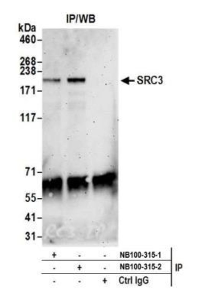 NCOA3/AIB1 Antibody 0.1mL; Unlabeled:Antibodies, Polyclonal | Fisher ...