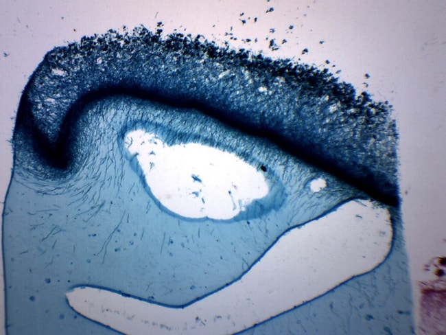 Eisco Prepared Microscope Slide - Fungi Molds, 3 Types, Whole Mount 1 ...