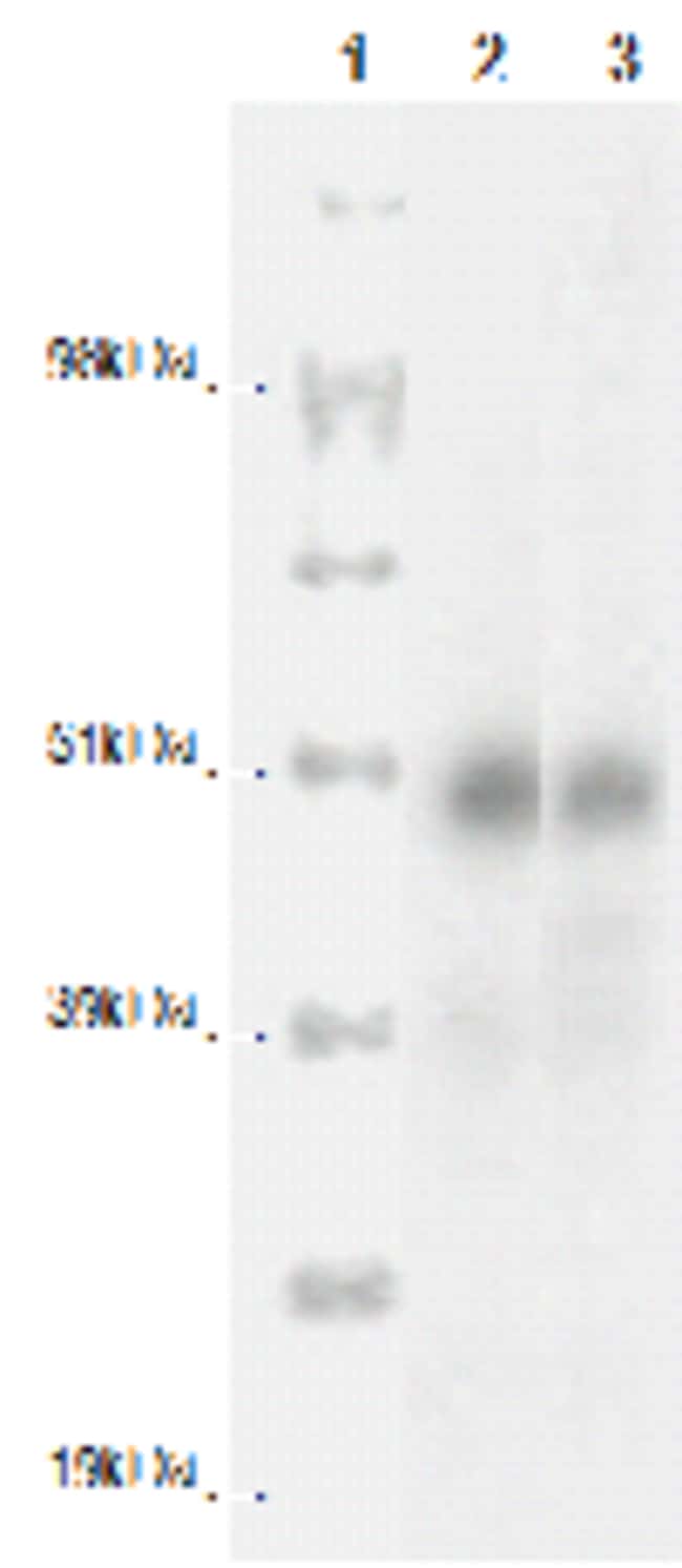 DiscoverX PathHunter eXpress CCRL2 CHO-K1 -Arrestin Orphan GPCR Assay 1 ...