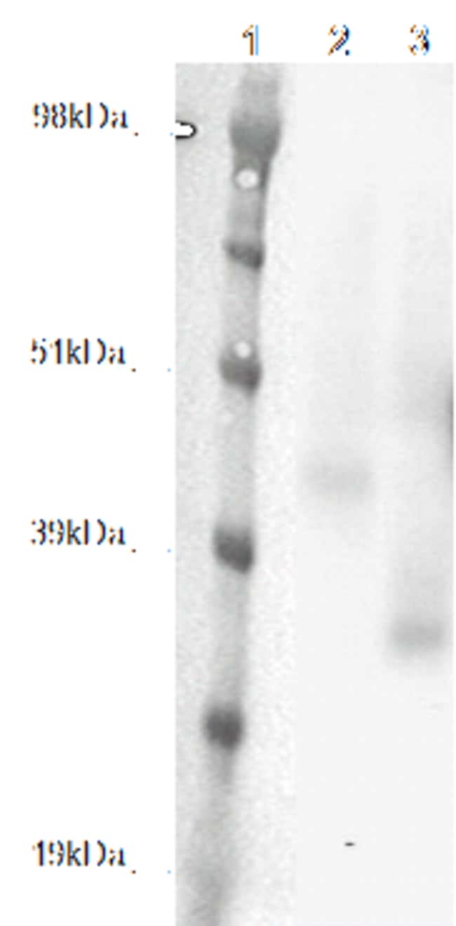 DiscoverX PathHunter eXpress GHSR1b CHO-K1 -Arrestin Orphan GPCR Assay ...