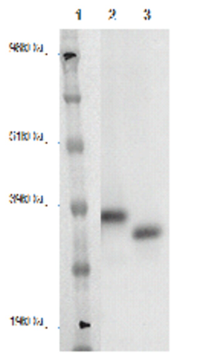 DiscoverX PathHunter eXpress GPR148 CHO-K1 -Arrestin Orphan GPCR Assay ...