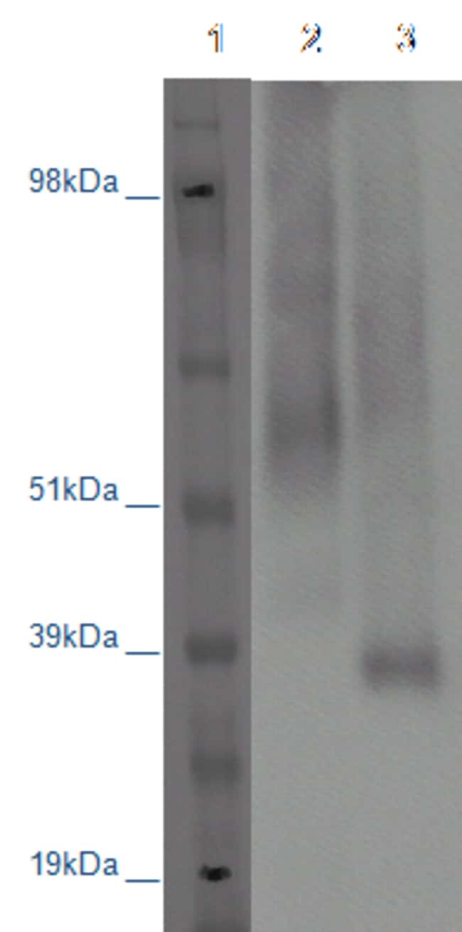 DiscoverX PathHunter CHO-K1 GPR52 -Arrestin Orphan GPCR Cell Line 2 ...