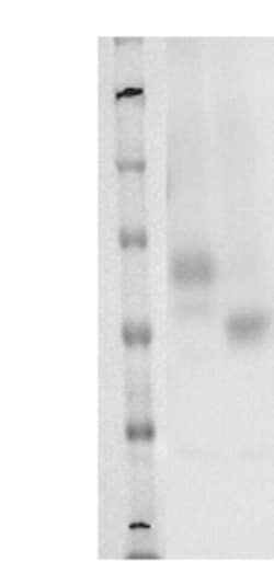 DiscoverX PathHunter eXpress GPR173 CHO-K1 -Arrestin Orphan GPCR Assay ...
