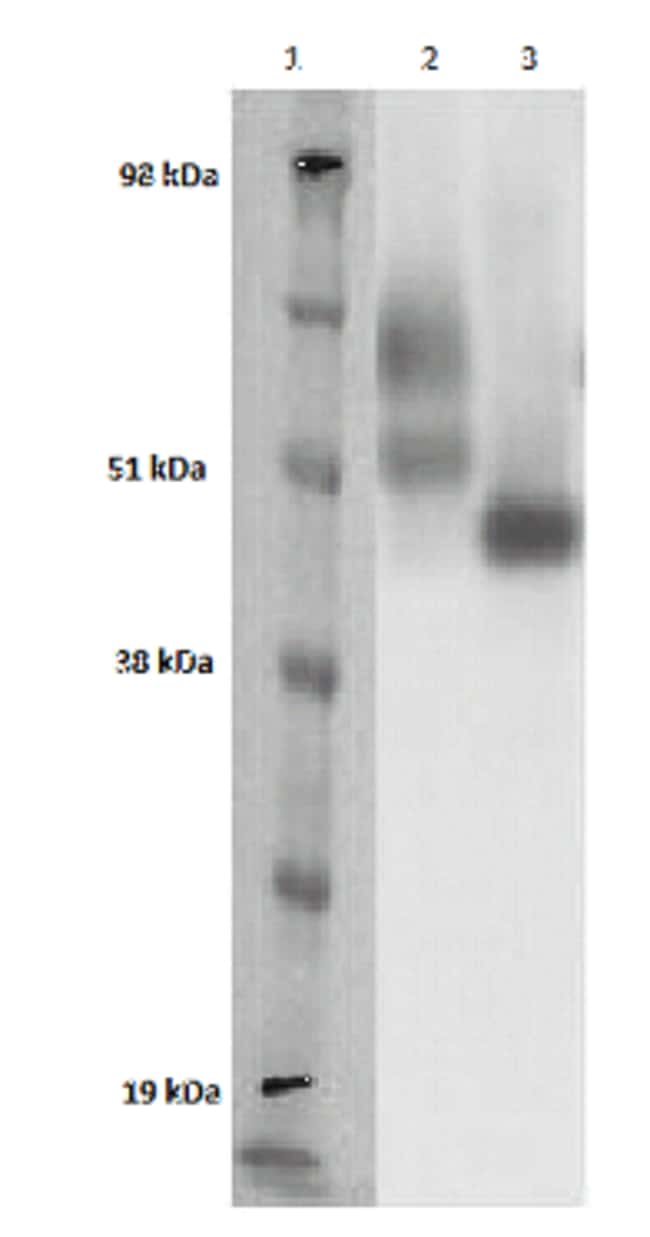 DiscoverX PathHunter CHO-K1 GPR151 -Arrestin Orphan GPCR Cell Line 2 ...