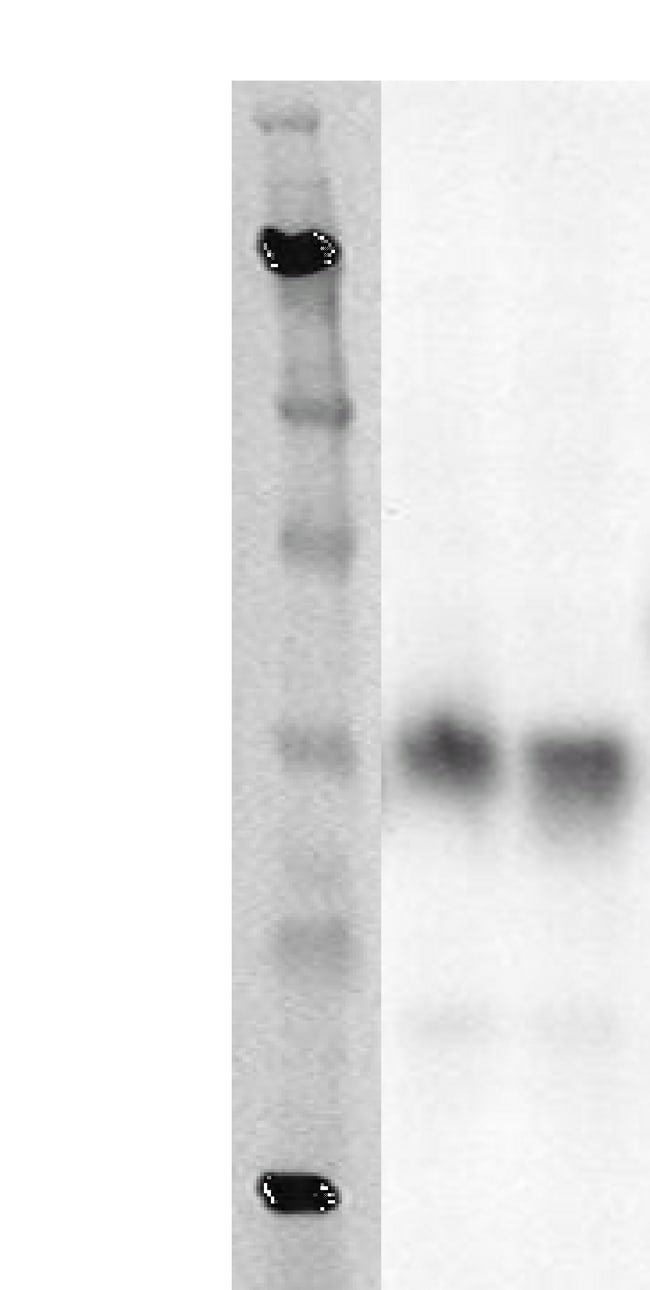 DiscoverX PathHunter eXpress GPR79 CHO-K1 -Arrestin Orphan GPCR Assay 1 ...