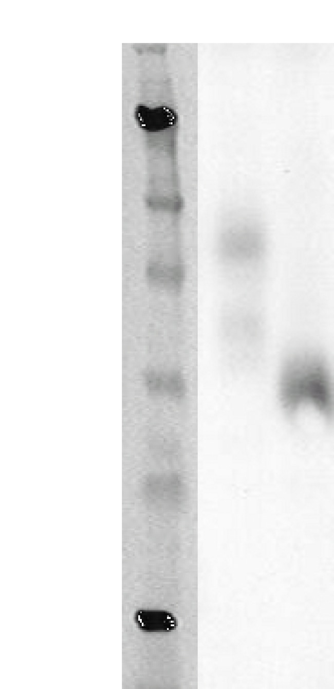 DiscoverX PathHunter eXpress GPR65 CHO-K1 -Arrestin Orphan GPCR Assay 1 ...