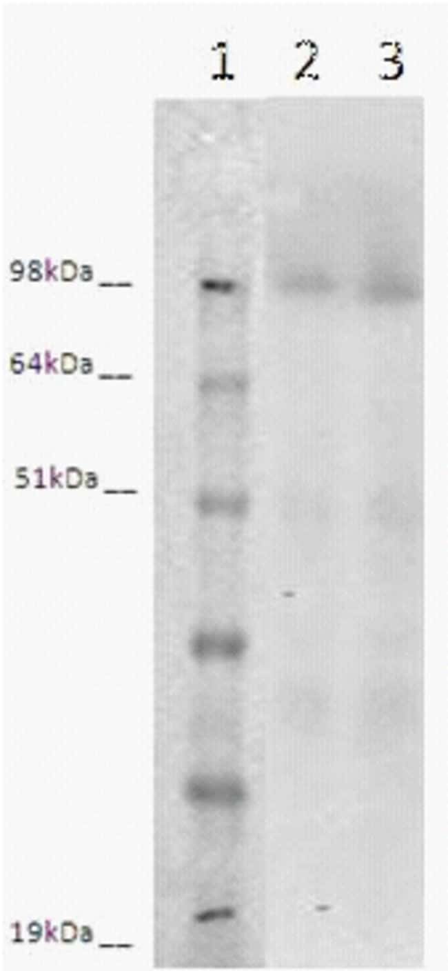 DiscoverX PathHunter eXpress LGR6 CHO-K1 -Arrestin Orphan GPCR Assay ...