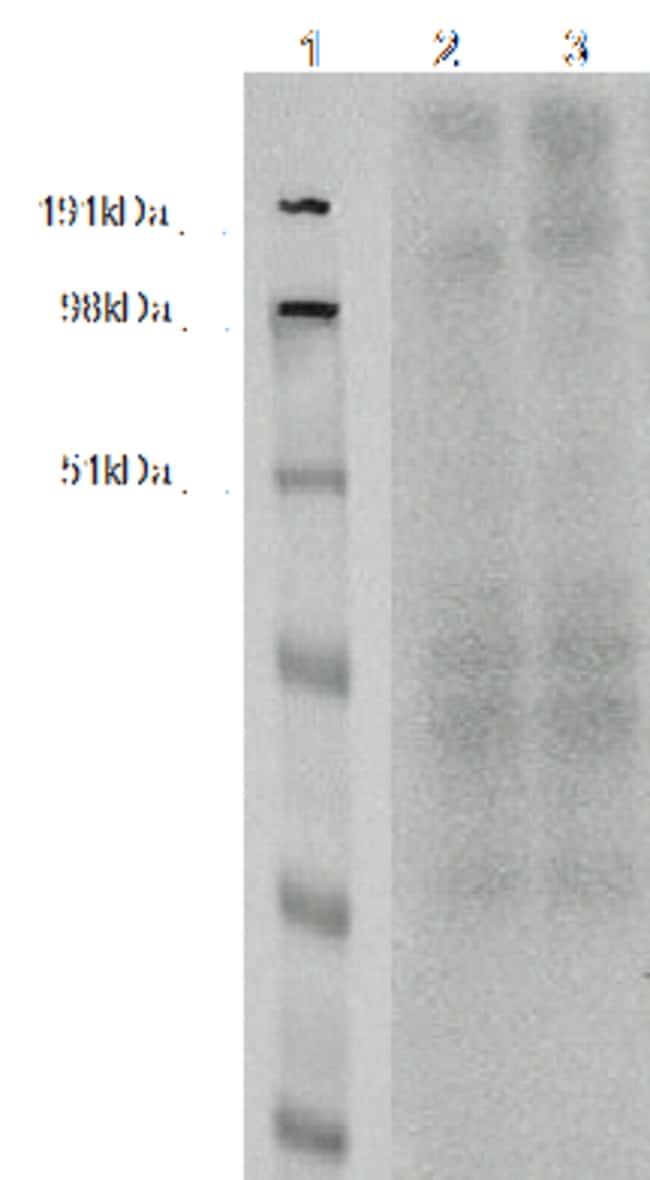 DiscoverX PathHunter CHO-K1 BAI1 -Arrestin Orphan GPCR Cell Line 2 ...