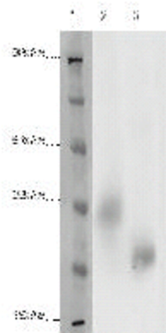 DiscoverX PathHunter eXpress GPR3 CHO-K1 -Arrestin Orphan GPCR Assay ...