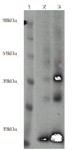 DiscoverX PathHunter eXpress GPR6 CHO-K1 -Arrestin Orphan GPCR Assay 1 ...