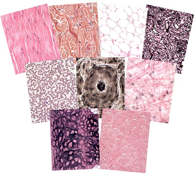 Visual Microscopy Learning Kit, Reticular Connective Tissue, Framed ...