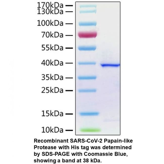 MP Biomedicals Recombinant SARS-CoV-2 Papain-like Protease (His tag) Quantity: | Fisher Scientific
