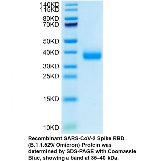 MP Biomedicals Recombinant SARS-CoV-2 Spike RBD (B.1.1.529/Omicron) Protein | Fisher Scientific