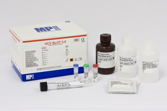 MP Biomedicals HCV Blot 3.0 (RUO) 18 Tests/Kit | Buy Online | MP ...