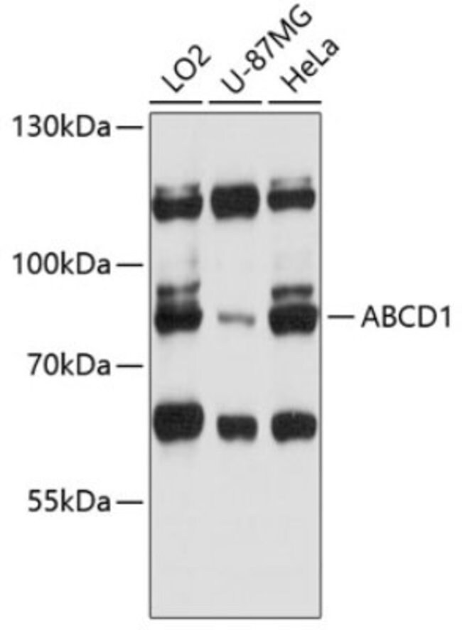 ABCD1 Rabbit anti-Human, Mouse, Rat, Polyclonal, Novus Biologicals 100 ...