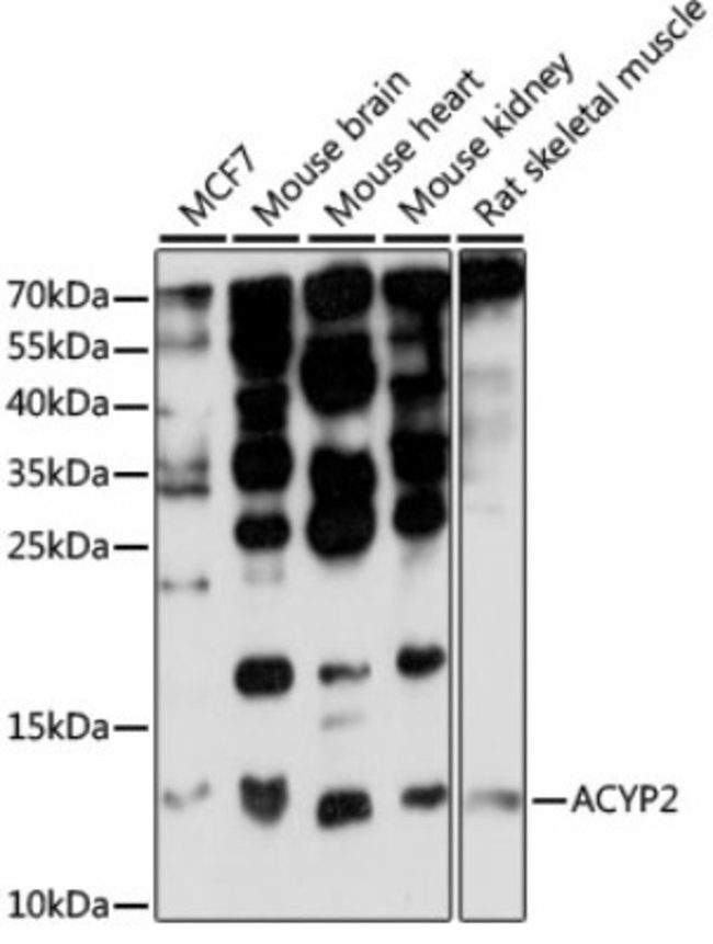 ACYP2 Rabbit anti-Human, Mouse, Rat, Polyclonal, Novus Biologicals 20 μg; | Fisher Scientific