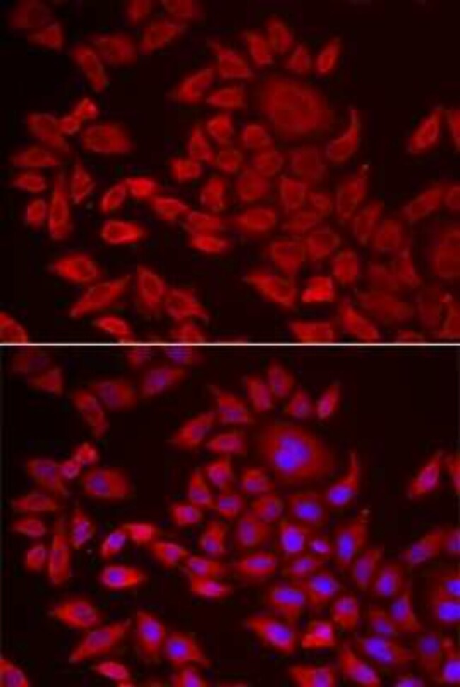 AGPAT2 Rabbit anti-Human, Mouse, Polyclonal, Novus Biologicals 20 μg ...