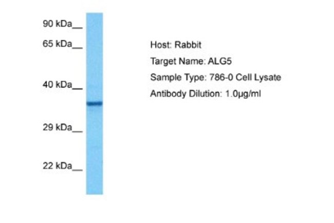 ALG5 Antibody, Novus Biologicals 100 μL; Unconjugated:Antibodies ...