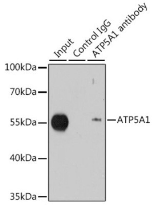 ATP5A Rabbit anti-Human, Mouse, Rat, Polyclonal, Novus Biologicals 20 μg; | Fisher Scientific