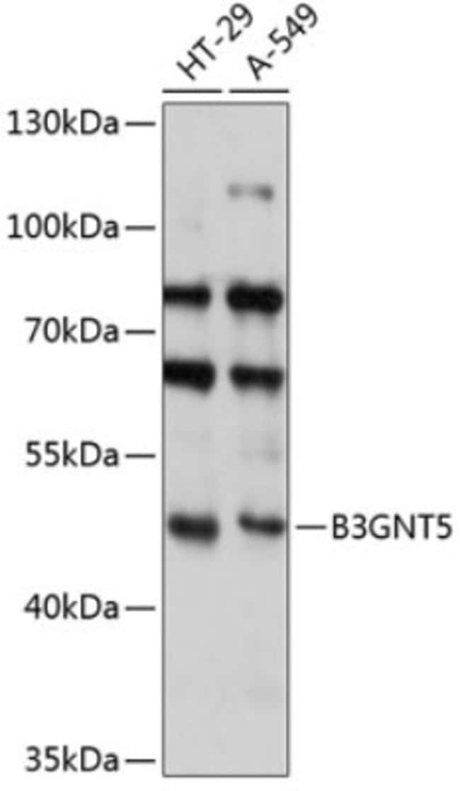 B3GNT5 Rabbit anti-Human, Mouse, Polyclonal, Novus Biologicals 100 μg; | Fisher Scientific