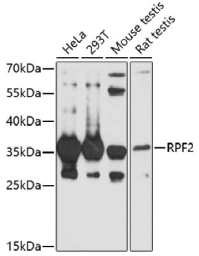 BXDC1 Rabbit anti-Human, Mouse, Rat, Polyclonal, Novus Biologicals:Antibodies:Primary | Fisher ...