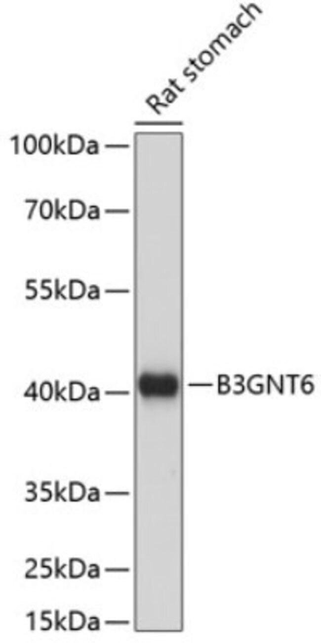 Beta-1,3-N-Acetylglucosaminyltransferase 6/B3GNT6 Rabbit anti-Rat ...
