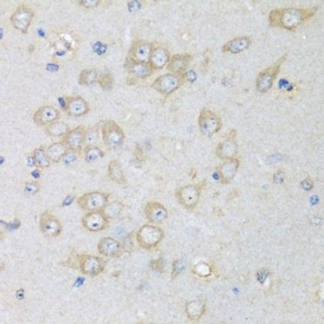 CHMP1B Rabbit anti-Human, Mouse, Rat, Polyclonal, Novus Biologicals 100 | Fisher Scientific