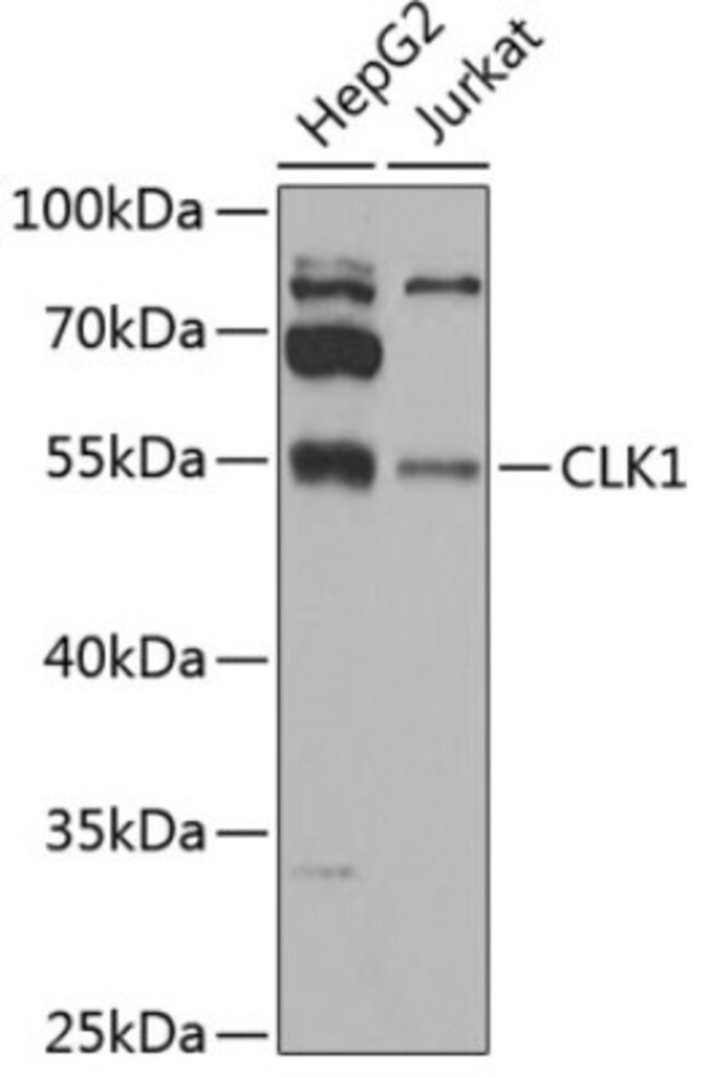 CLK1 Rabbit anti-Human, Mouse, Polyclonal, Novus Biologicals 100 μg ...