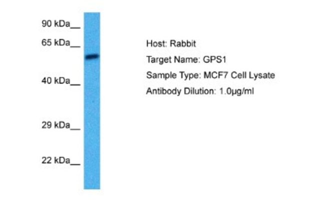 CSN1 Antibody 100 μL; Unconjugated:Antibodies, Polyclonal | Fisher ...