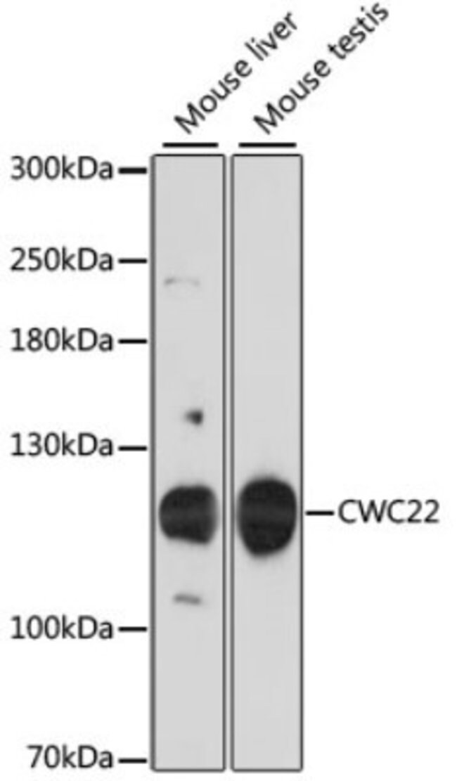 CWC22 Rabbit anti-Mouse, Polyclonal, Novus Biologicals:Antibodies ...