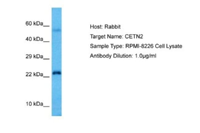Centrin 2 Rabbit anti-Human, Polyclonal, Novus Biologicals 0.1ml ...
