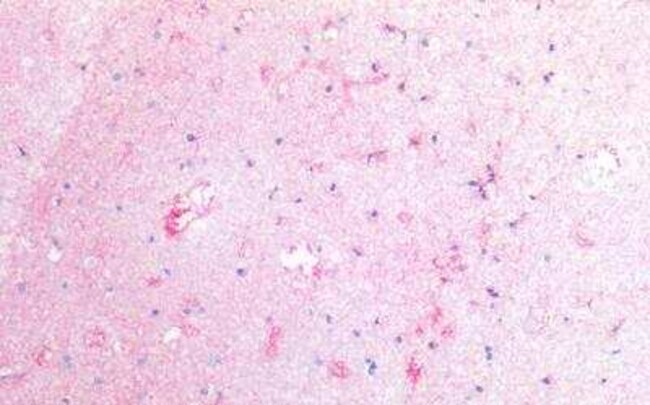 Coagulation Factor III/Tissue Factor Antibody (HTF-1), Novus ...