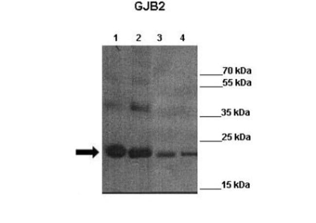 Connexin 26/GJB2 Rabbit anti-Human, Polyclonal, Novus Biologicals 100 ...