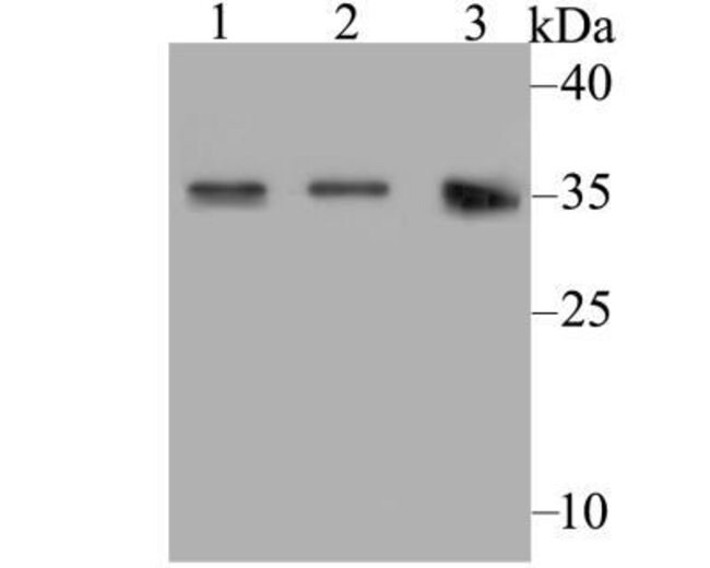 Connexin 32/GJB1 Rabbit anti-Human, Mouse, Polyclonal, Novus ...