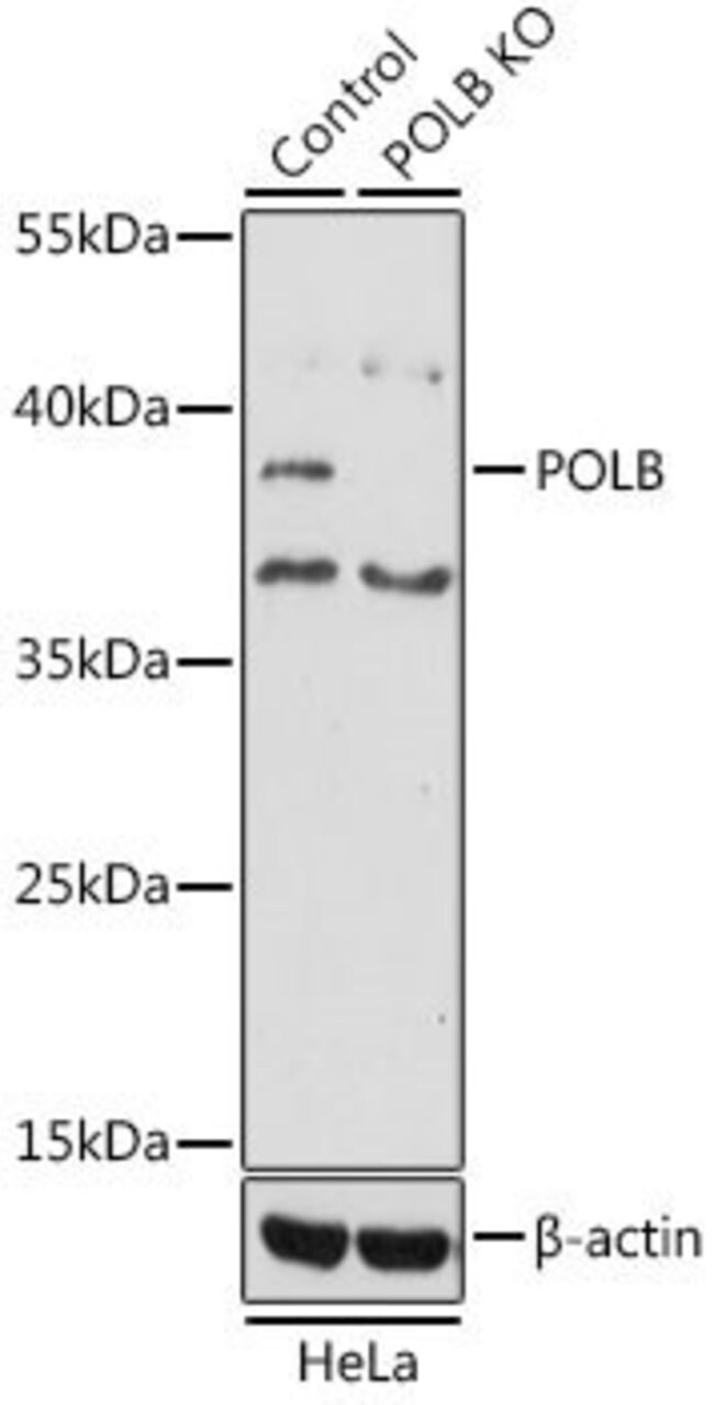 DNA POLYMERASE BETA - 20 UL