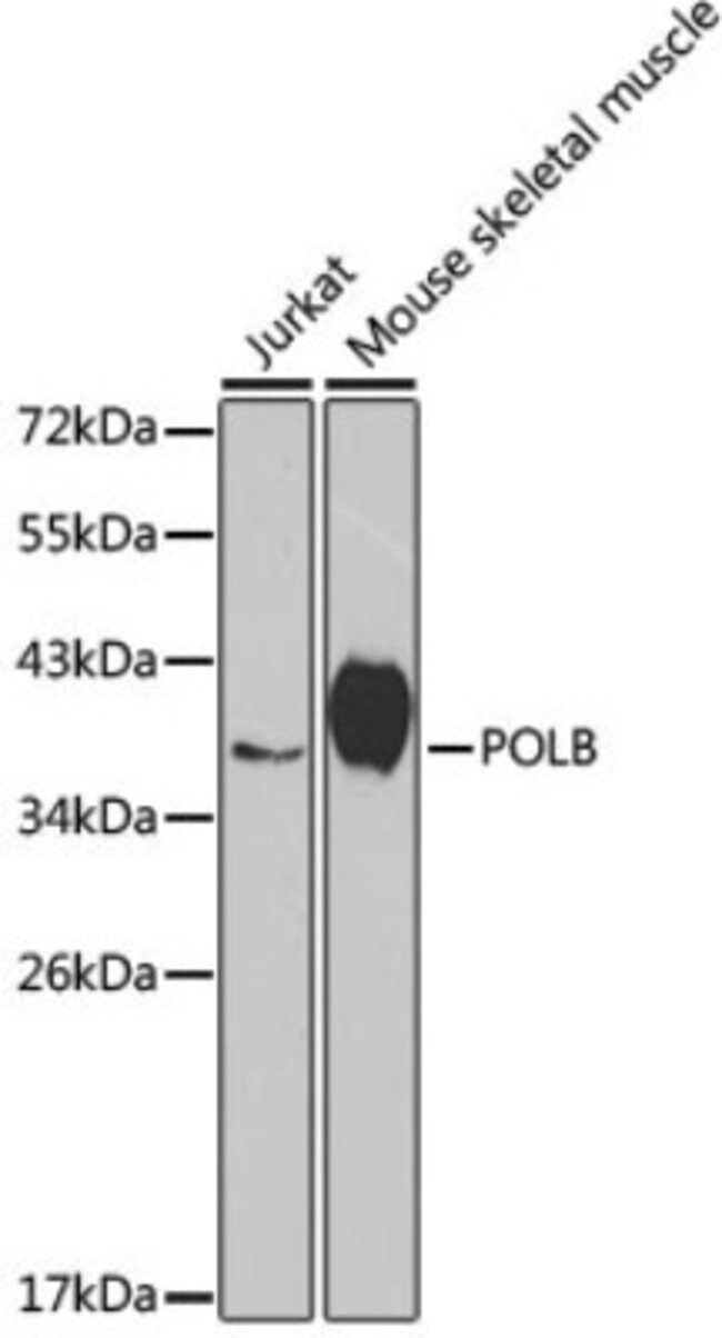 DNA POLYMERASE BETA - 20 UL