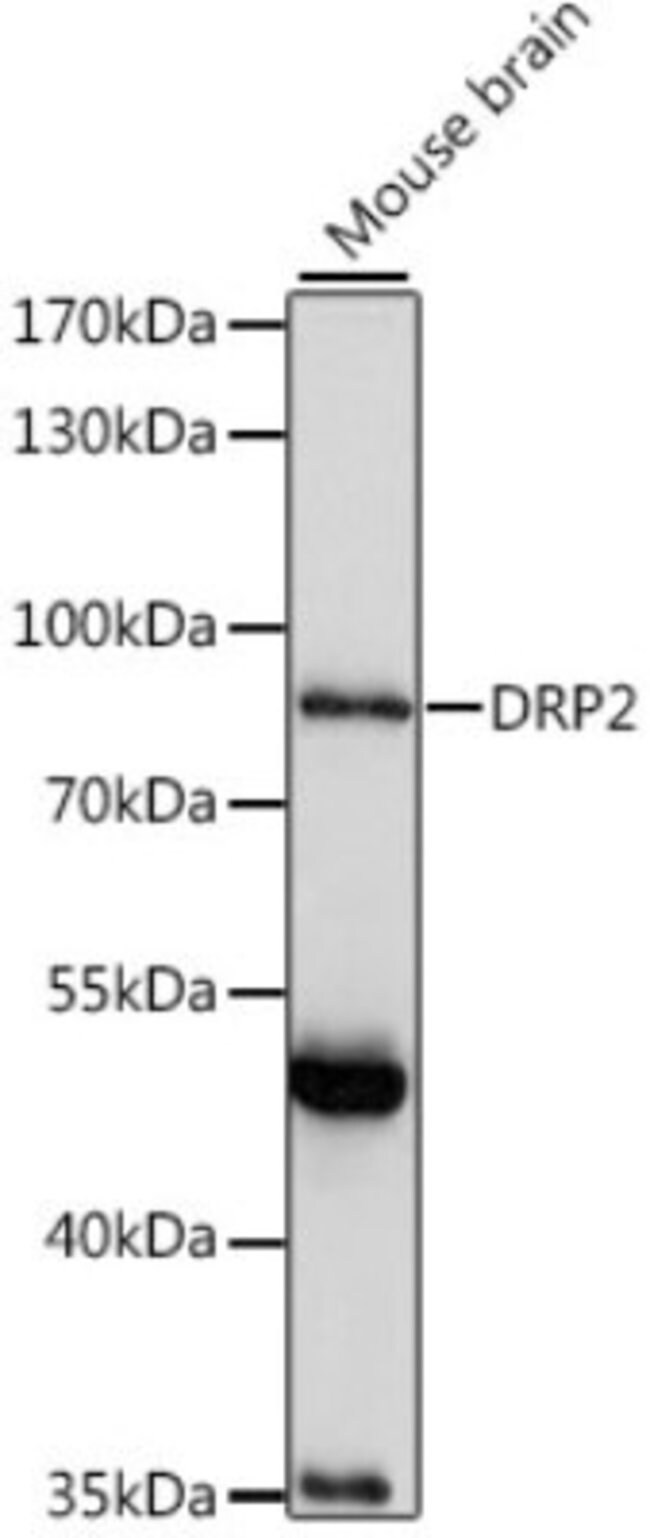 DRP2 Rabbit anti-Mouse, Rat, Polyclonal, Novus Biologicals:Antibodies ...