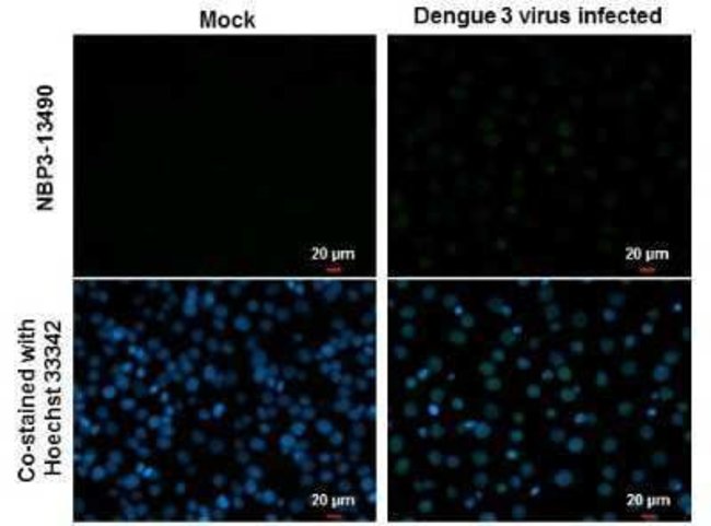Dengue Virus NS5 Mouse anti-Virus, Clone: GT361, Novus Biologicals 100 ...