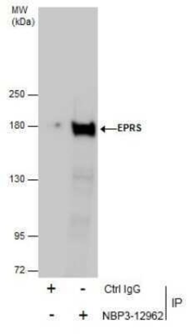 EPRS Antibody, Novus Biologicals 100 μg; Unconjugated:Antibodies, Polyclonal | Fisher Scientific