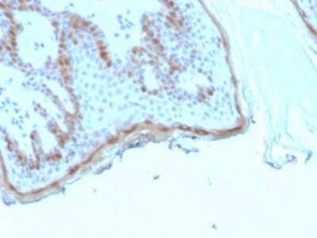 Filaggrin Mouse anti-Human, Clone: rFLG/1945, Novus Biologicals 20 μg ...