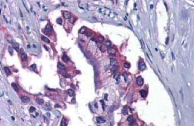 GFPT1 Antibody, Novus Biologicals 50 μg; Unconjugated:Antibodies ...