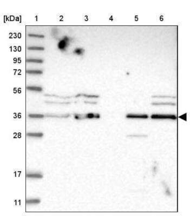 GRHPR Antibody, Novus Biologicals:Antibodies:Primary Antibodies | Fisher Scientific