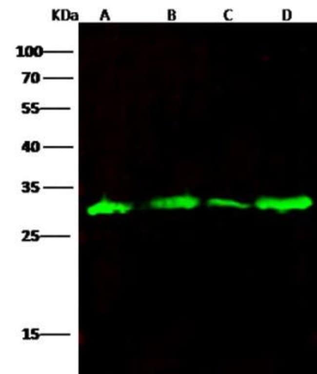 Galectin-3 Rabbit anti-Human, Clone: 78, Novus Biologicals 50 μg ...